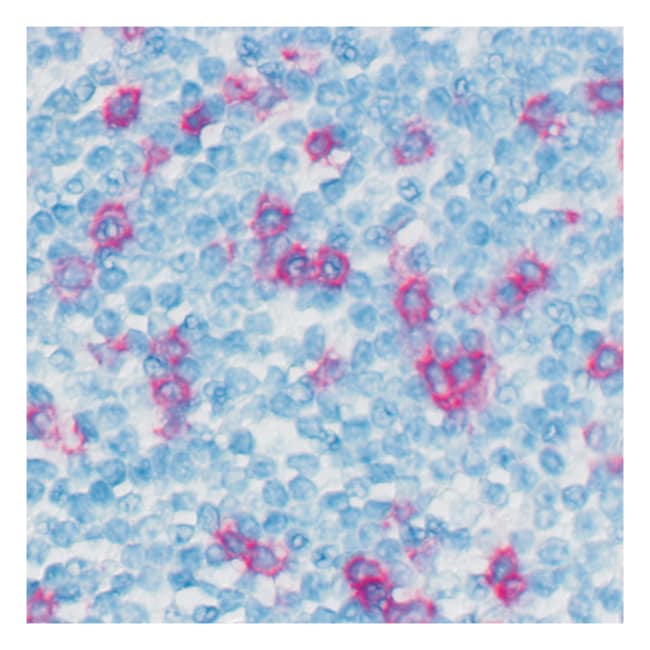 Epredia Lab Vision CD8 Rabbit Monoclonal Antibody 1mL; Unlabeled ...