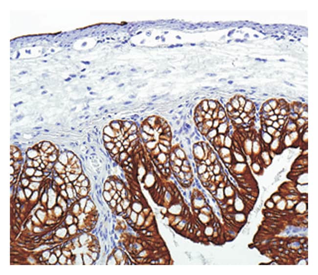 Epredia™ UltraVision™ Quanto Mouse on Mouse UltraVision Quanto Mouse on Mouse HRP, 60 ml ...