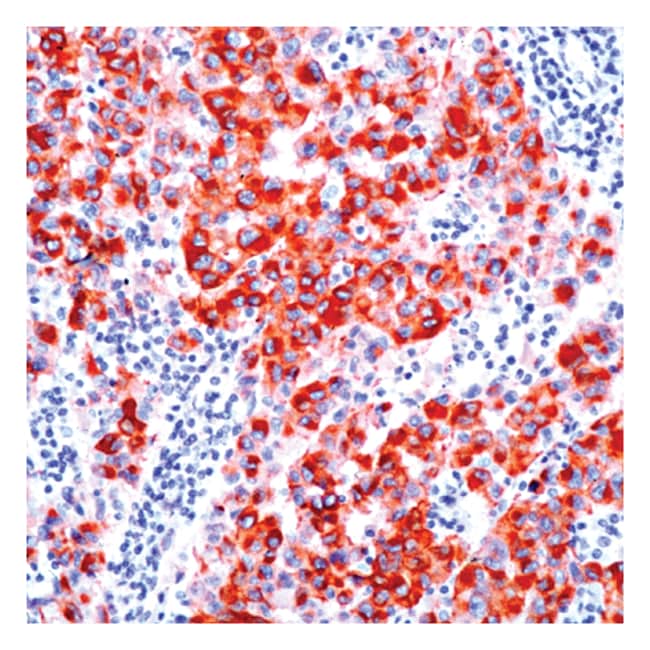 Epredia Lab Vision Melanoma (gp100) Ab-1, Mouse Monoclonal Antibody ...