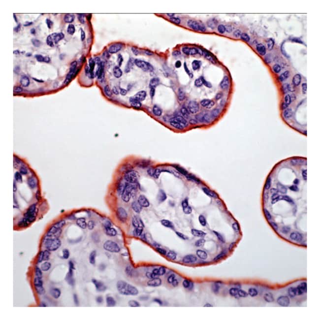 Insulin Receptor ( -subunit) Ab-2 Mouse Monoclonal Antibody, Epredia ...