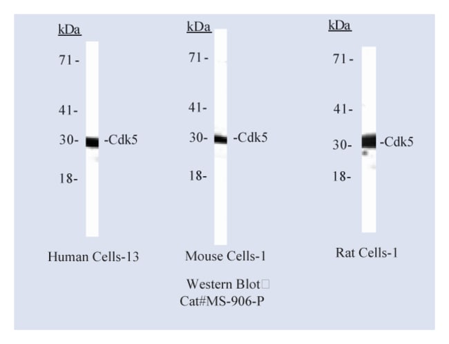 EprediaLab Vision Cdk5 Ab-3 Mouse Monoclonal Antibody with BSA and azide | Fisher Scientific
