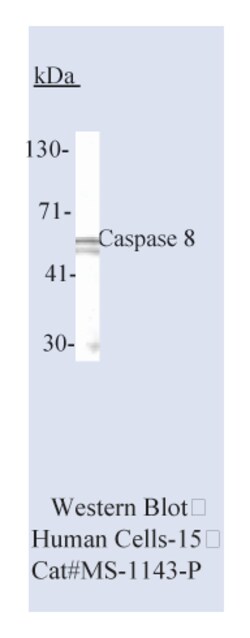 Epredia Lab Vision Actin, Smooth Muscle, Ab-1 Mouse Monoclonal Antibody ...