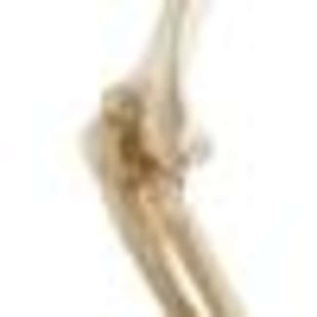 3B Scientific ORTHObones Standard Elbow Elastic Bands l Workshop Elbow ...