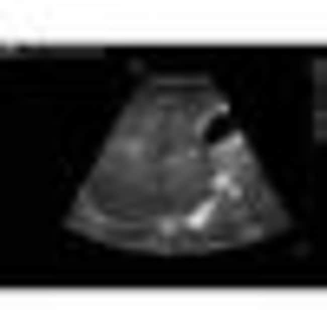 3B Scientific Blue Phantom FAST, TEE and TTE Training Model Ultrasound ...
