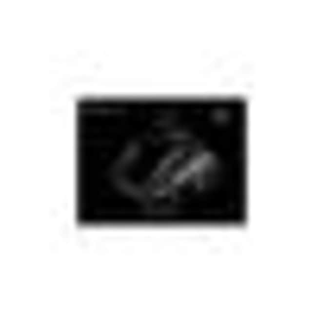 3B Scientific Blue Phantom Transesophageal Echo and Transthoracic Echo ...