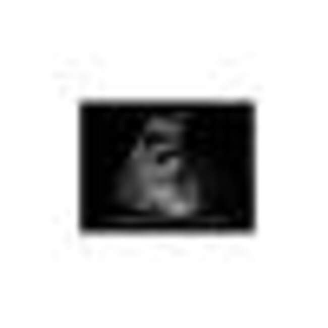 3B Scientific Blue Phantom Transesophageal Echo and Transthoracic Echo ...