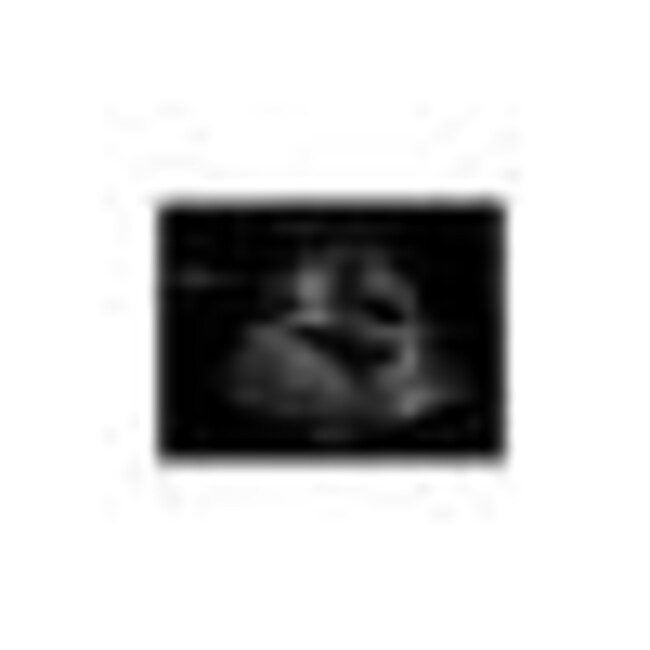3B Scientific Blue Phantom Transthoracic Echocardiography and ...