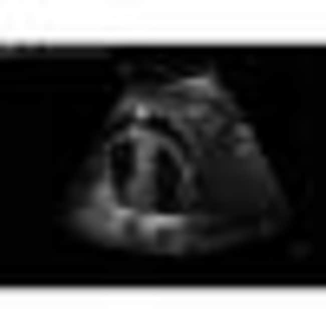 3B Scientific Blue Phantom TTE Ultrasound Training Platform Without ...