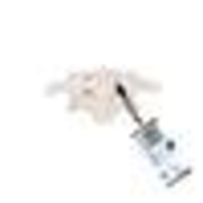 3B Scientific Human Atlas & Axis Model, Wire Mounted Atlas and Axis ...