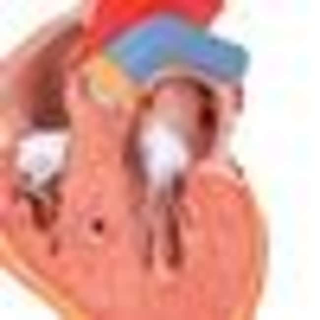 3B Scientific Classic Human Heart Model with Left Ventricular ...