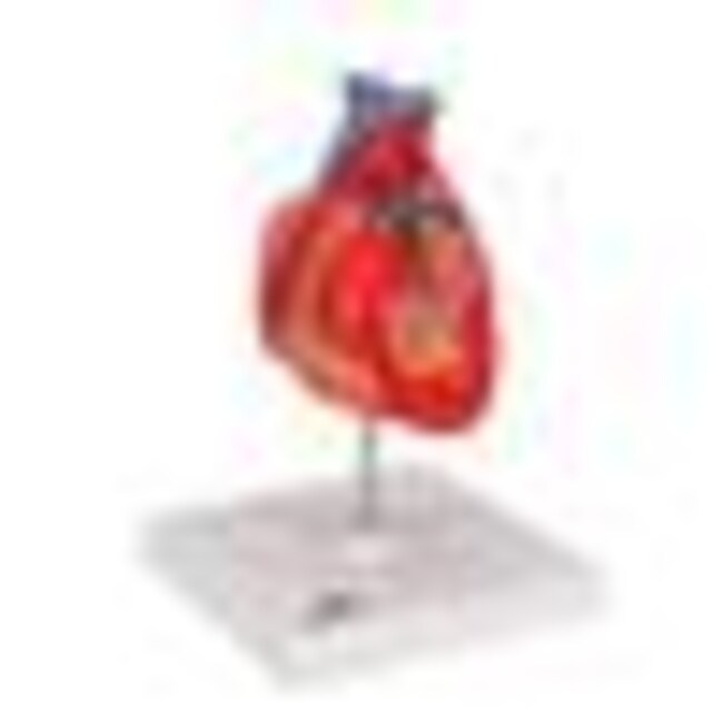 3B Scientific Classic Human Heart Model with Bypass Human Heart Model ...