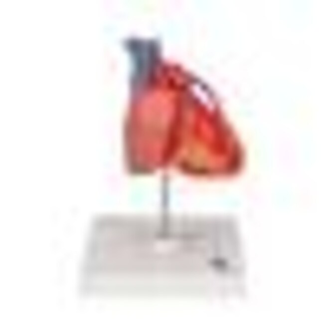 3B Scientific Classic Human Heart Model with Bypass Human Heart Model ...
