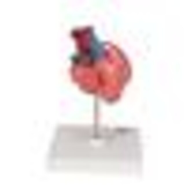 3B Scientific Classic Human Heart Model with Bypass Human Heart Model ...