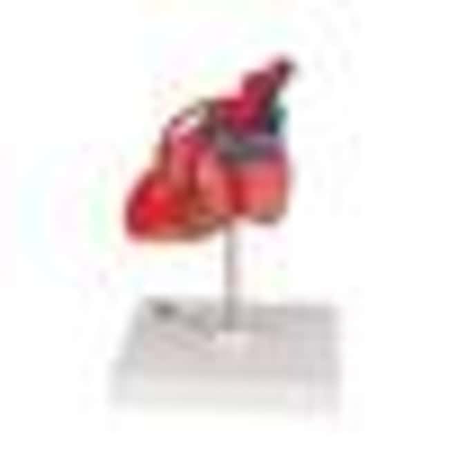 3B Scientific Classic Human Heart Model with Bypass Human Heart Model ...