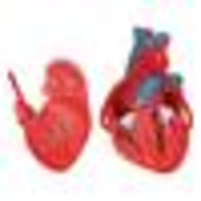 3B Scientific Classic Human Heart Model with Bypass Human Heart Model ...