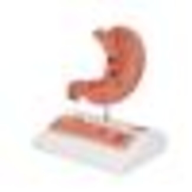3B Scientific Human Stomach Section Model with Ulcers Human Stomach ...