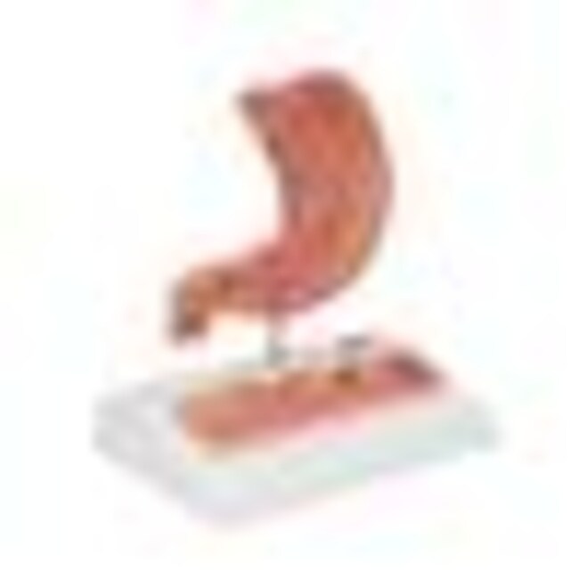 3B Scientific Human Stomach Section Model with Ulcers Human Stomach ...
