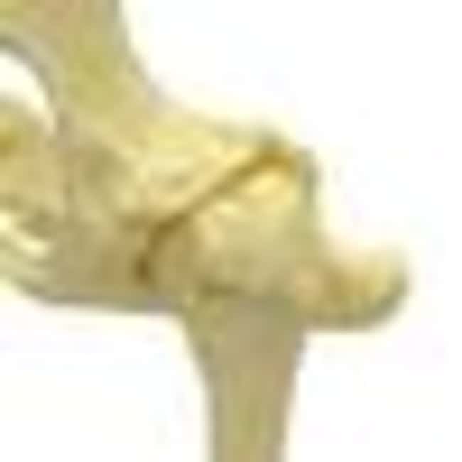 3B Scientific Canine Pelvis (Hip) Model Canine Pelvis; Includes: Normal ...