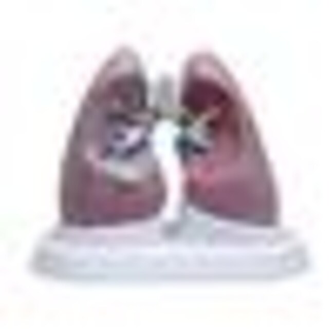 3B Scientific Lung Set with Pathologies Lung Set; Dimensions: 4.25 x 5. ...
