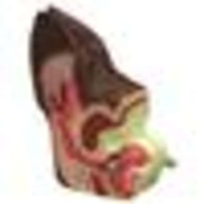 3B Scientific Canine Ear Model Canine Ear Model; Includes: Normal and ...