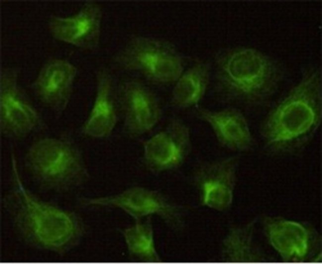 CBR1 Mouse anti-Human, Clone:2C9-B12-C4, Abnova 100μg:Antibodies ...