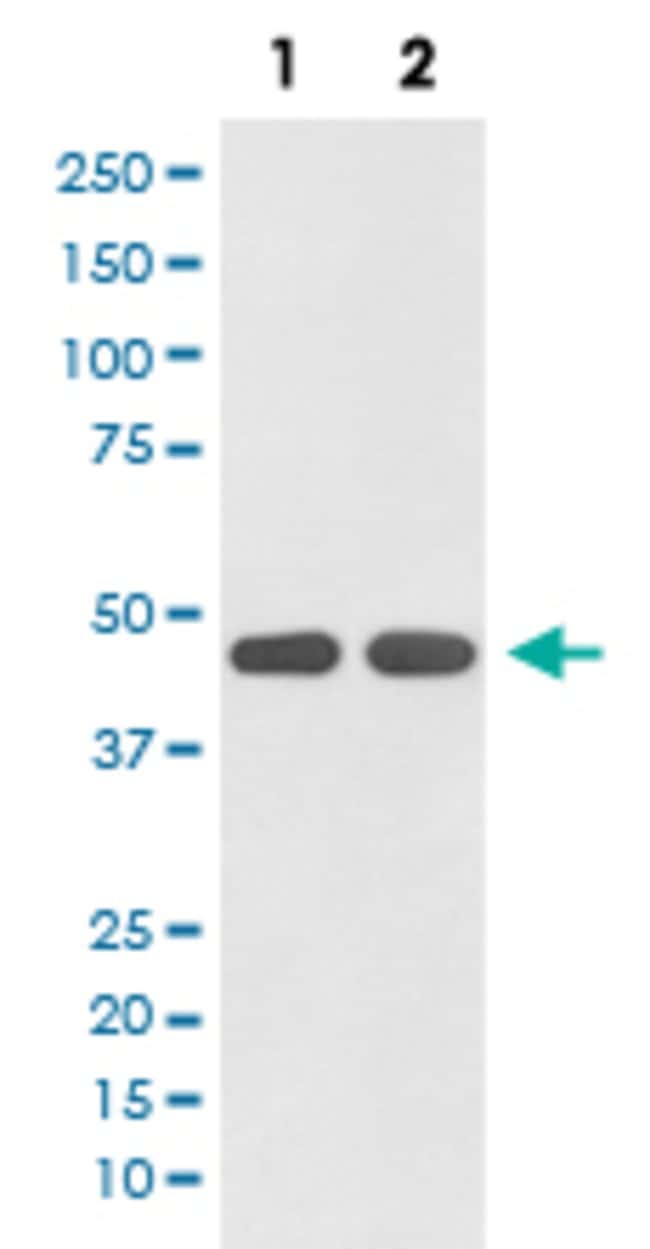 AGTR1 Rabbit anti-Human, Mouse, Rat, Unconjugated, Clone: AOGD-1 ...