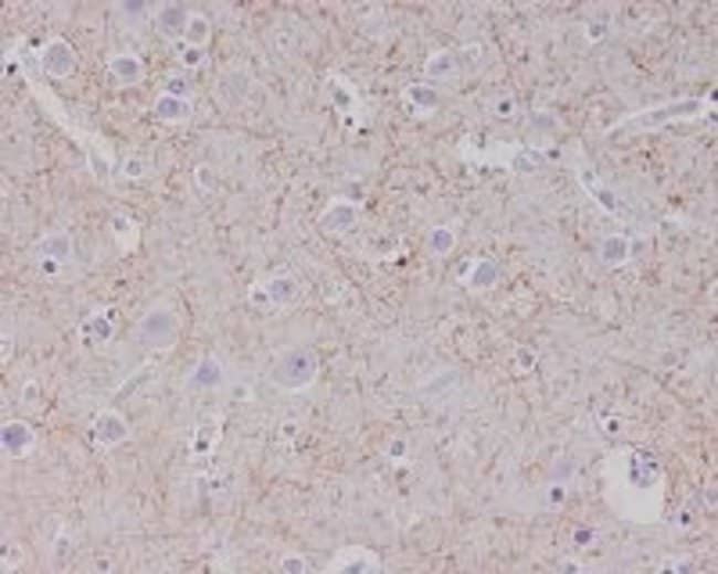APP Rabbit anti-Human, Mouse, Rat, Unconjugated, Clone: BGC-1 , Abnova ...