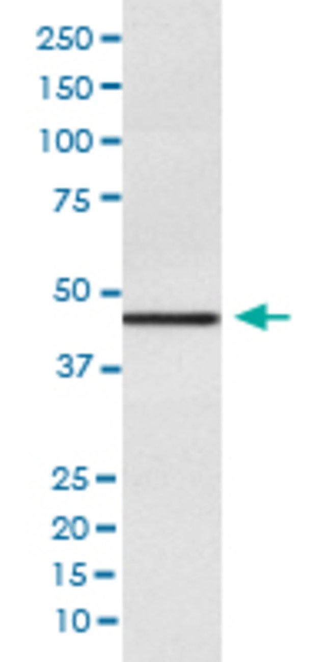 PAX2 Rabbit anti-Human, Unconjugated, Clone: BDA-16, Abnova 100 μg ...