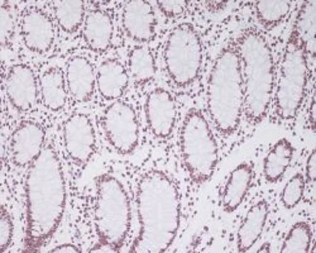 PAX2 Rabbit anti-Human, Unconjugated, Clone: BDA-16, Abnova 100 μg ...