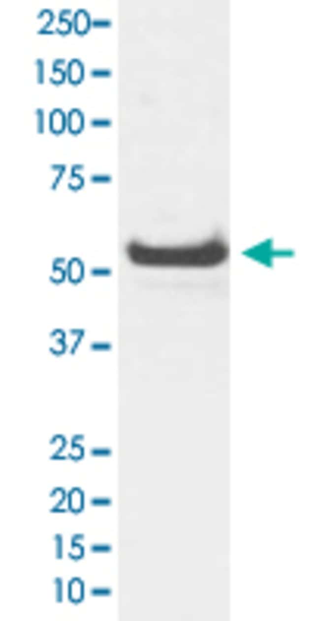 MAPK10 Rabbit anti-Human, Unconjugated, Clone: HGC-13, Abnova 100 μg; | Fisher Scientific