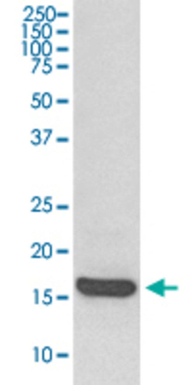 MAP1LC3A Rabbit anti-Human, Unconjugated, Clone: GCH-13, Abnova 100 μg ...