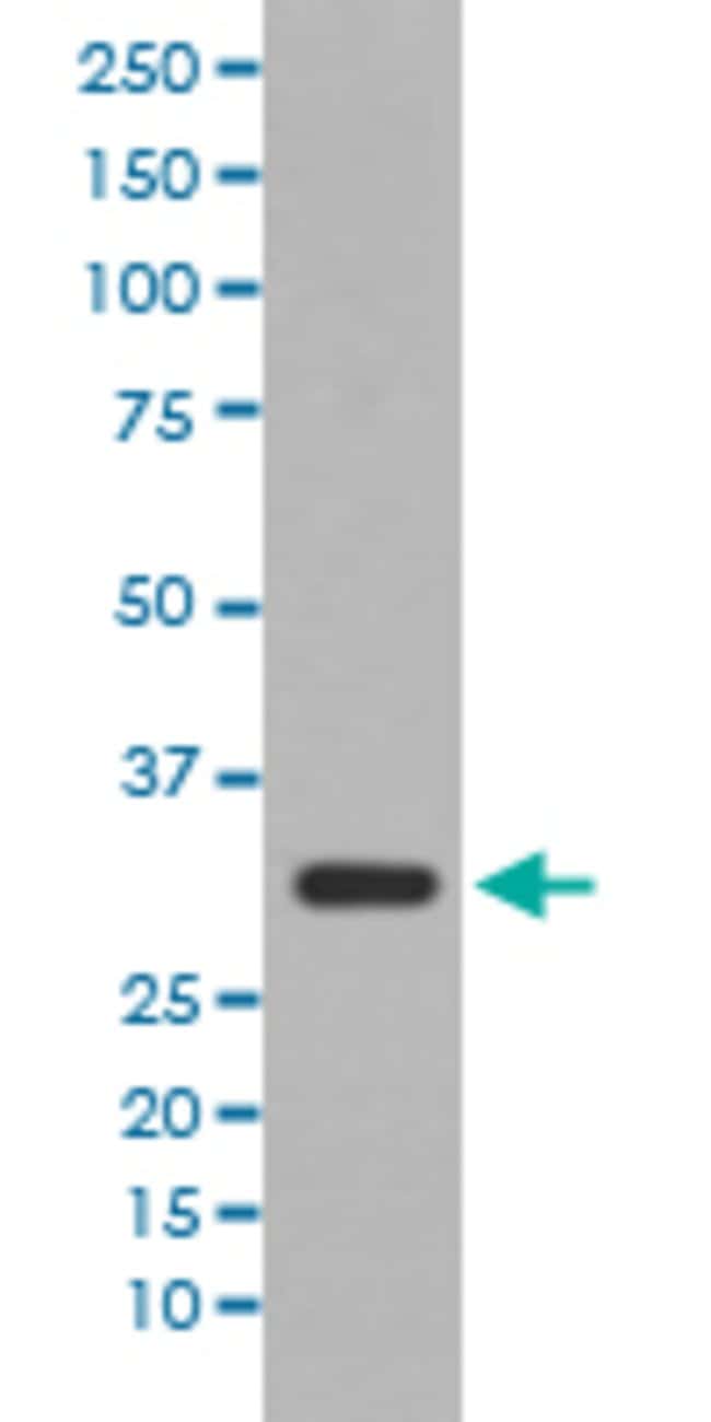 PIM1 Rabbit anti-Human, Unconjugated, Clone: ECB-16, Abnova 100 μg ...