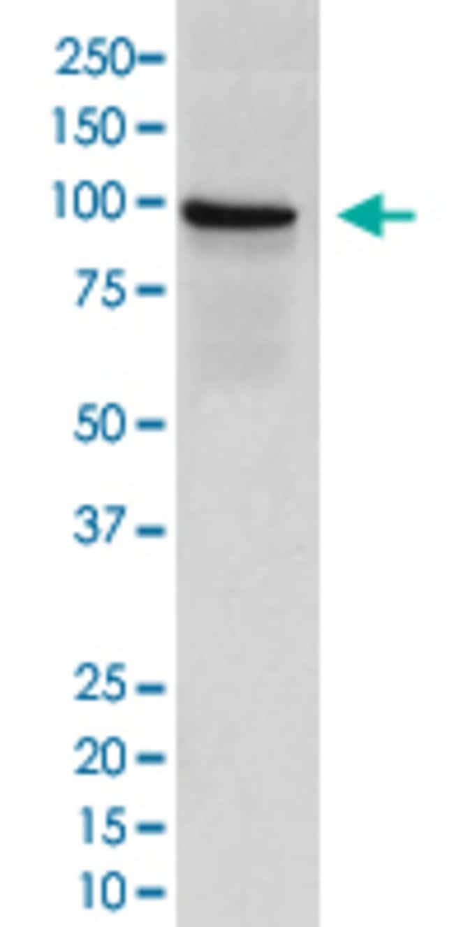 THBD Rabbit anti-Human, Unconjugated, Clone: COO-20, Abnova 100 μg ...