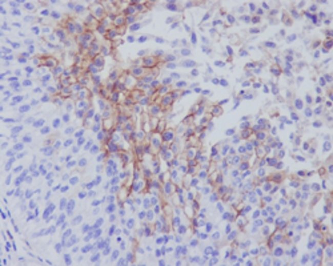 THBD Rabbit anti-Human, Unconjugated, Clone: COO-20, Abnova 100 μg ...