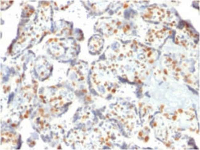 DNMT3A Mouse anti-Human, Unconjugated, Clone: PCRP-DNMT3A-1E2, Abnova ...