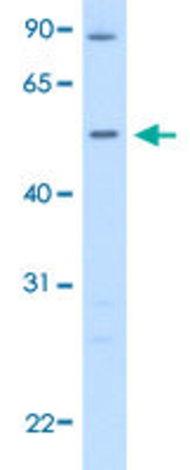 GPT Rabbit anti-Human, Polyclonal, Abnova 100uL:Antibodies, Polyclonal ...