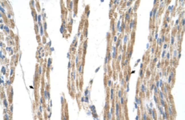 GPT Rabbit anti-Human, Polyclonal, Abnova 100uL:Antibodies, Polyclonal ...