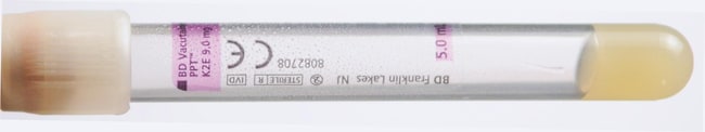 BD Vacutainer™ PPT™ Plasma Preparation Tubes 5.0mL; Size: 13 x 100mm BD ...