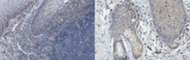 Angiogenin Mouse anti-Mouse, Clone: C527, MilliporeSigma 100 μg ...