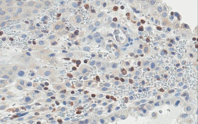 HLA-F, Mouse anti-Human, Clone: 3D11, Millipore Sigma 100μg ...