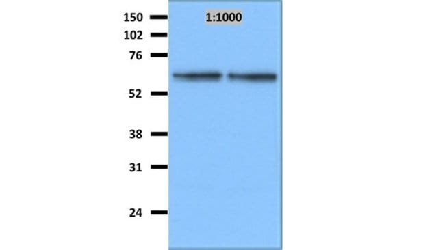 VSV-Glycoprotein Mouse anti-Virus, Clone: 1E9F9, MilliporeSigma 100 μL ...