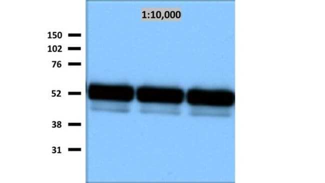 VSV-Glycoprotein Mouse anti-Virus, Clone: 8G5F11, MilliporeSigma ...