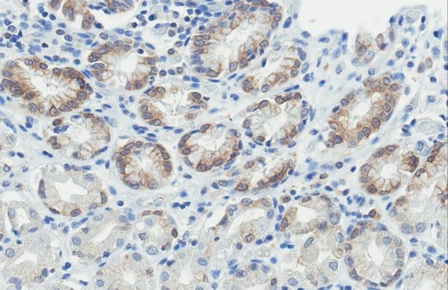 CLN6, Mouse anti-Human, Clone: N400/24 , Millipore Sigma 25μg ...