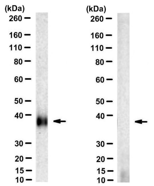 MT-ND4, Mouse anti-Human, Clone: 9E4-2D8, Millipore Sigma 25μg ...