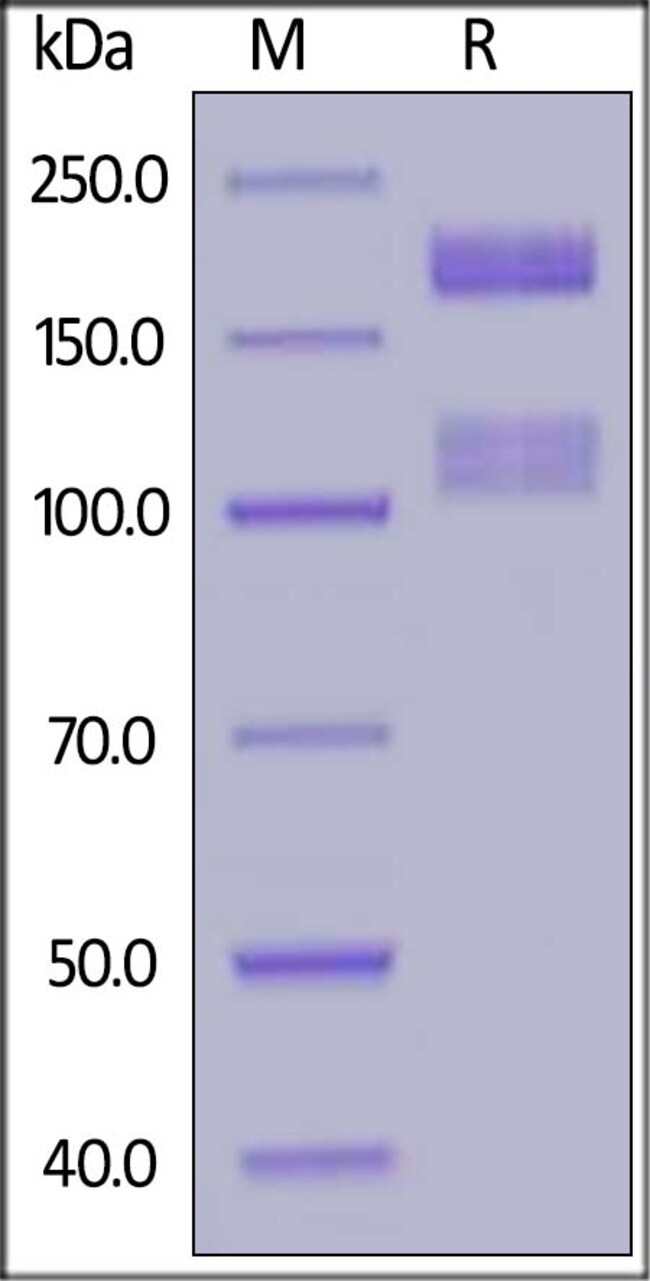 ACROBiosystems Human Integrin alpha 1 beta 1 (ITGA1&ITGB1) Heterodimer ...