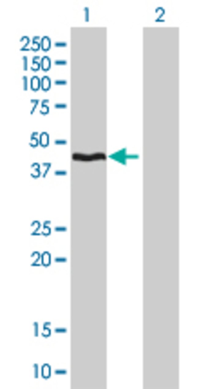 Hmbs Mouse Anti Human Clone 3e8 Abnova™ 100μg Unconjugated