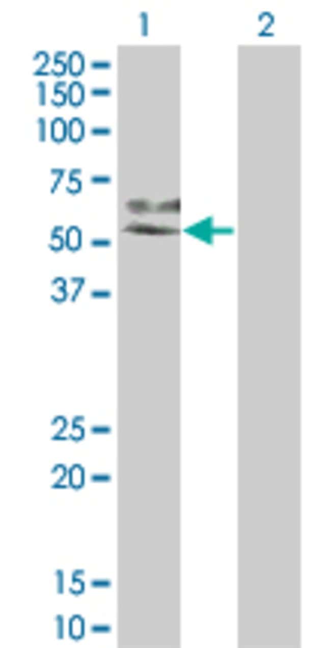 MAP2K7, Mouse anti-Human, Clone: 2G5, Abnova 100μg; Unconjugated ...