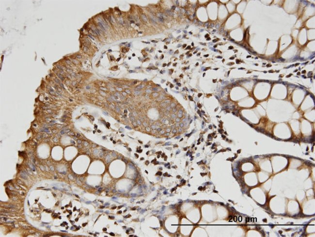 TUBB2A, Mouse anti-Human, Clone: 3F9, Abnova 100μg; Unconjugated ...