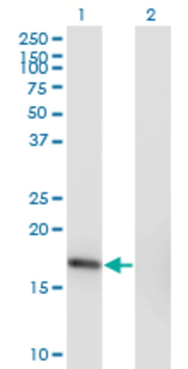 Snx3 Mouse Anti Human Clone 3a9 Abnova™ 100μg Unconjugated