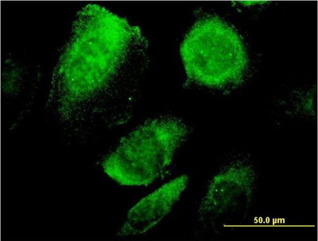 Bcap29 Mouse Anti Human Clone 4b10 Abnova™ 100μg Unconjugated